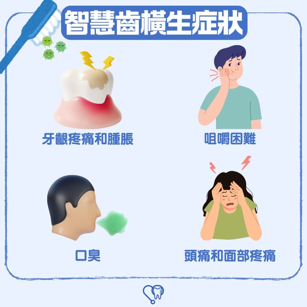 智慧齒橫生怎麼辦？會導致蛀牙或發炎嗎？一文解析5大潛在口腔問題與剝智慧齒手術流程